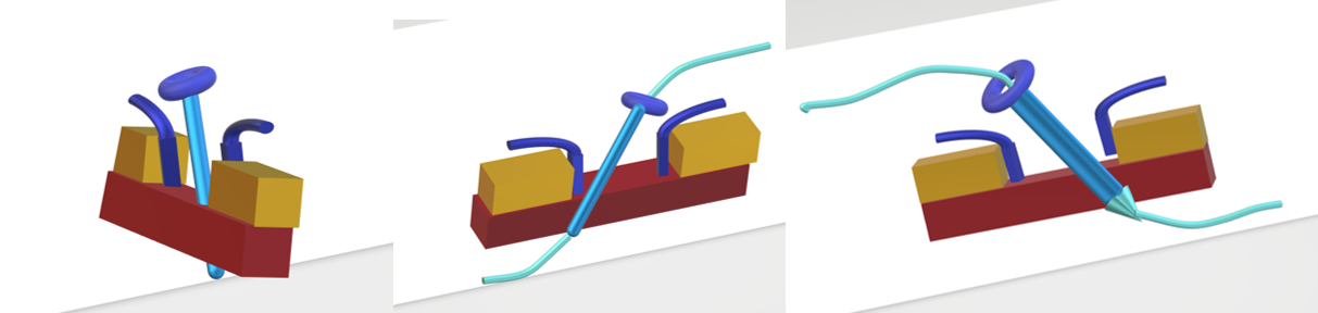 Tenckhoff Catheter Insertion by a Nephrologist - Renal Fellow Network