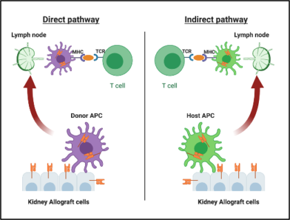 Basic Immunologic Principles in Transplantation - Renal Fellow Network