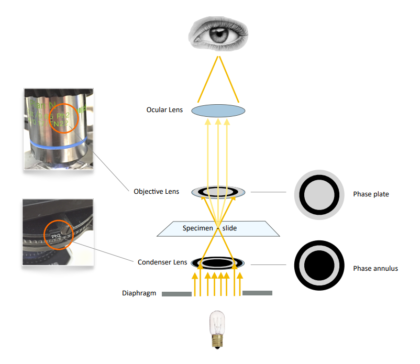 Urine Sediment of the Month: Transmitted Light Microscopy Techniques ...