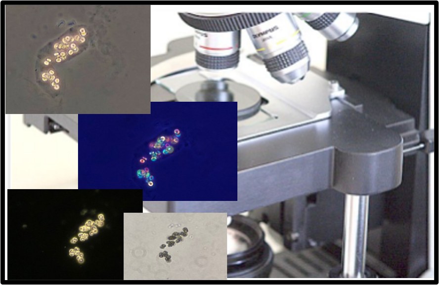 Urine Sediment of the Month: Transmitted Light Microscopy Techniques ...