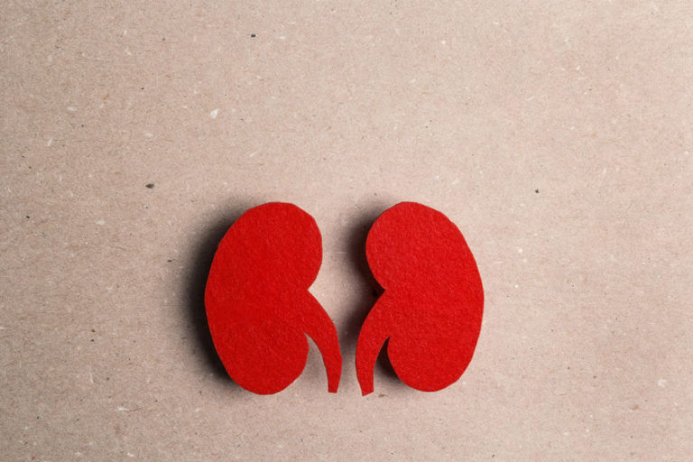 Urine Sediment of the Month: Isolated Lipiduria - Renal Fellow Network