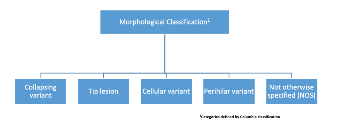 Kidney Biopsy of the Month: Focal Segmental Glomerulosclerosis - Renal ...