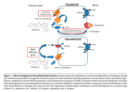 Skeleton Key Group Case 15: Why So Ampho-terrible? - Renal Fellow Network