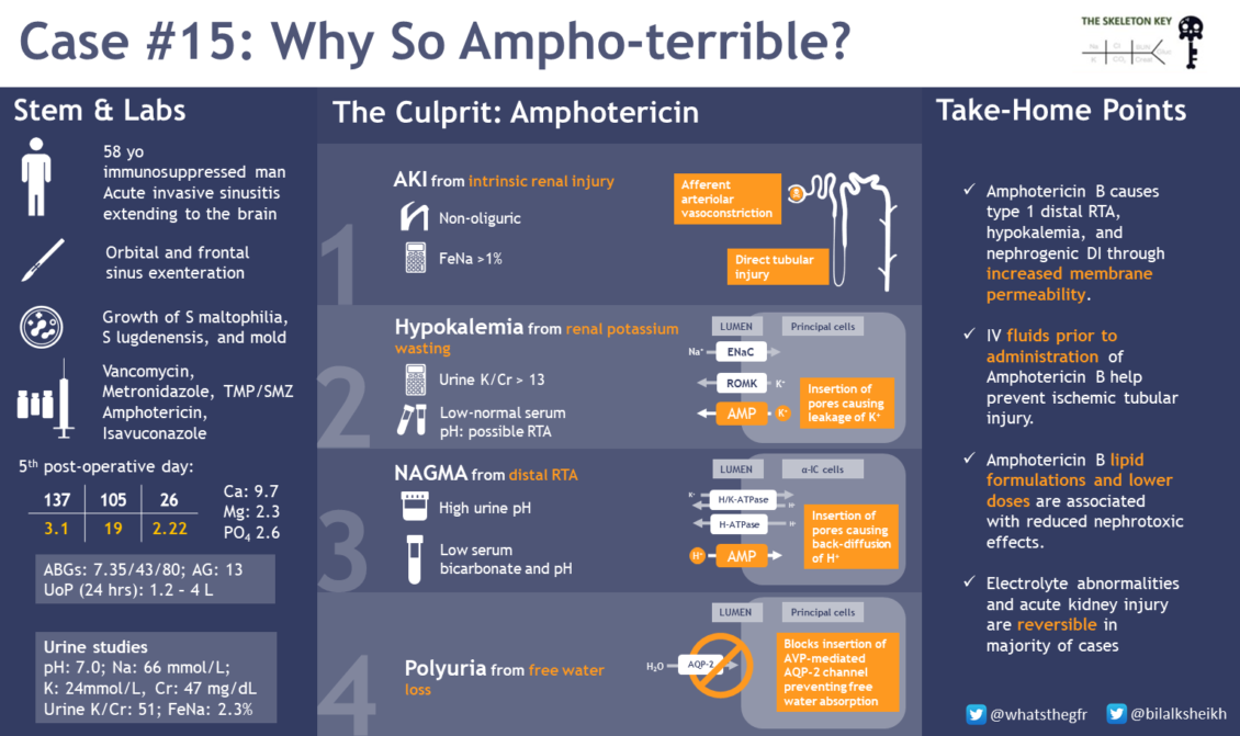 Skeleton Key Group Case 15: Why So Ampho-terrible? - Renal Fellow Network