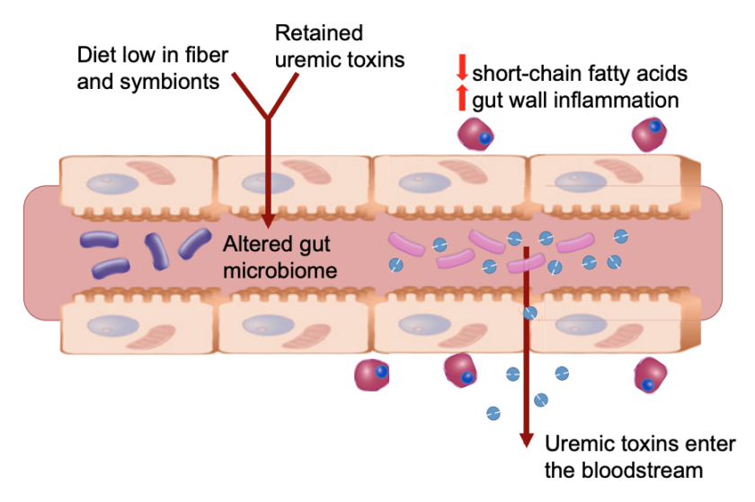 Evolving function of the gut microbiota in kidney disease - Renal ...