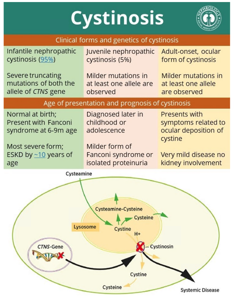 Cystinosis Archives - Renal Fellow Network