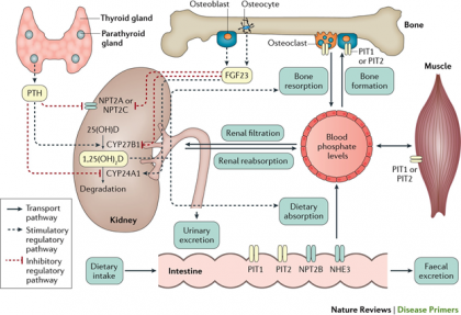 Skeleton Key Group Case #25: Falling for Phosphate! - Renal Fellow Network