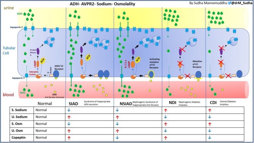 Skeleton Key Group Case #26: SIAD? ‘Food’ for thought! - Renal Fellow ...