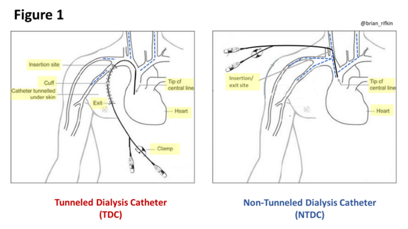 Urine Sediment of the Month: Another Look at Macroscopic Evaluation ...