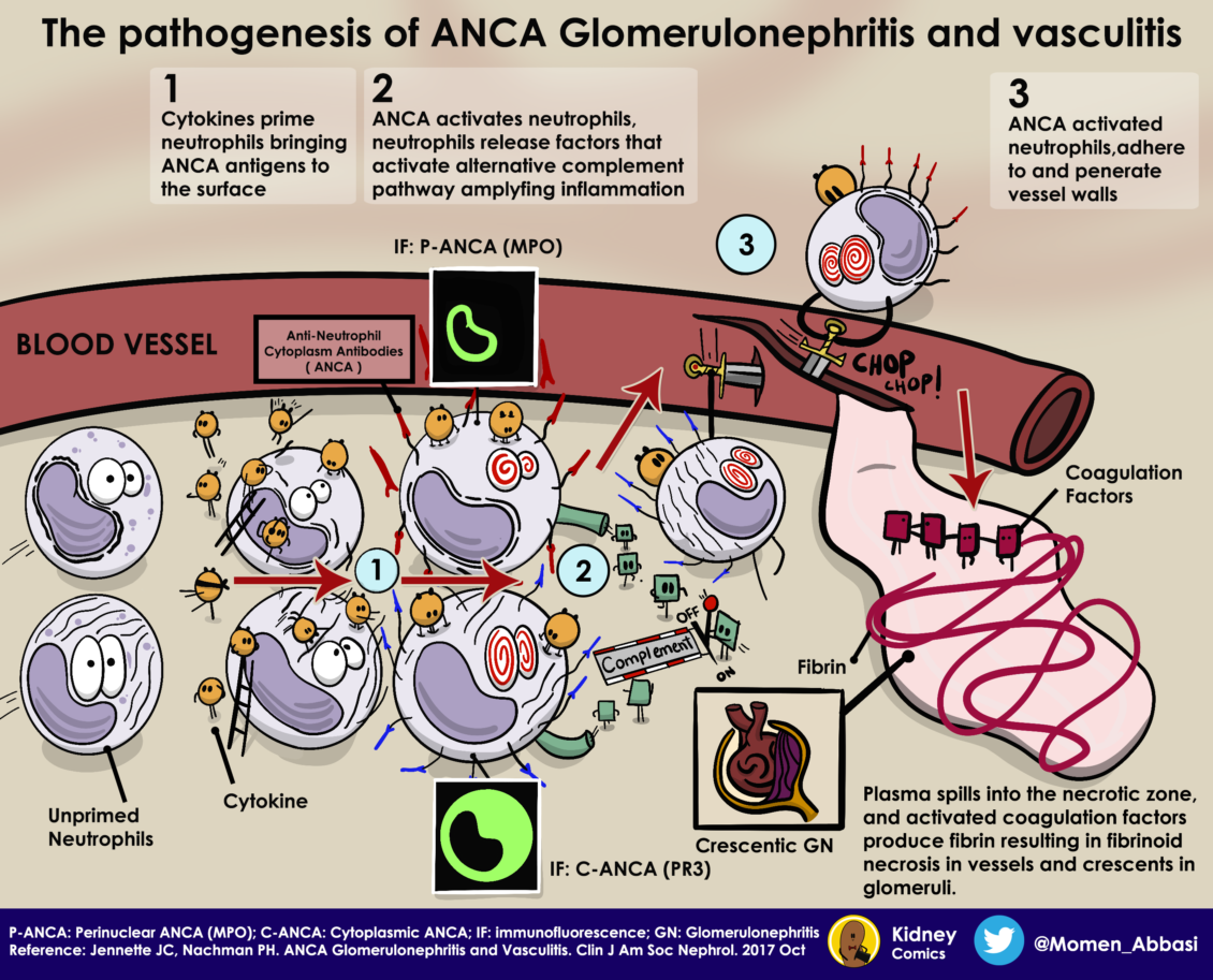 Kidney Comics Archives - Renal Fellow Network