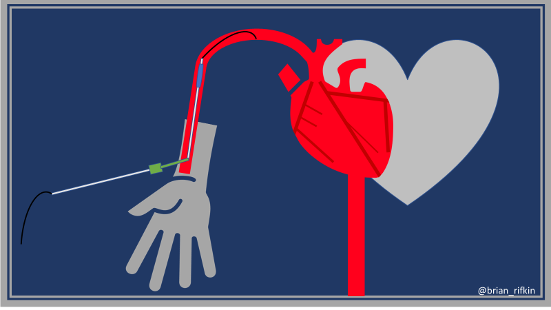 Radial Artery Cardiac Catheterization in Patients with Kidney Disease ...