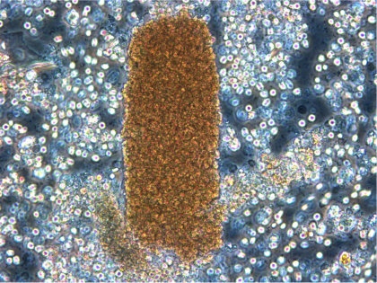 Disrupting Catheter Associated Fibrin Sheath Formation - Renal Fellow ...